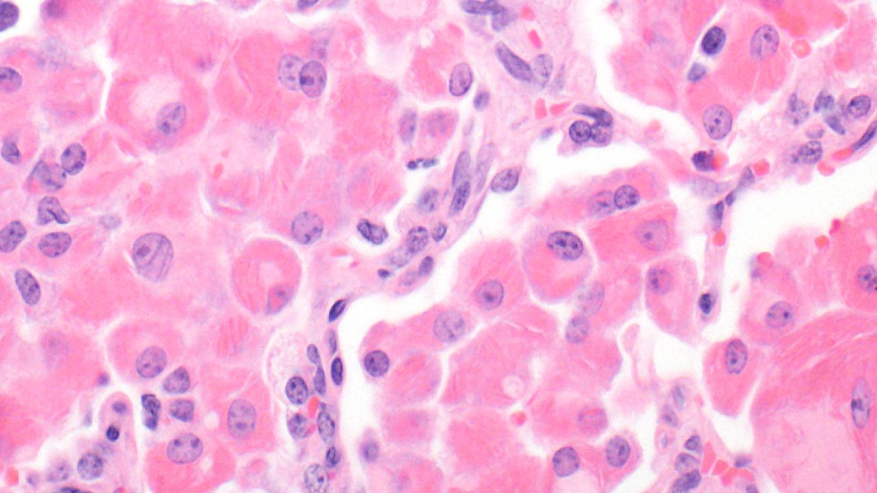 Anatomic Pathology | Comparative Pathology Laboratory (CPL) / School of ...